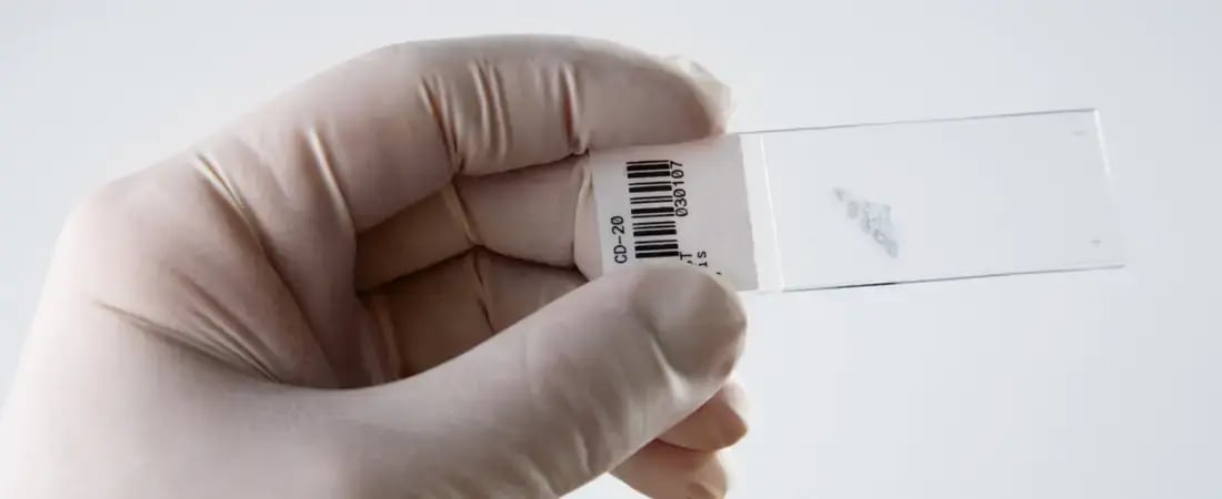 Le format DICOM, norme incontournable pour la numérisation de l’ACP